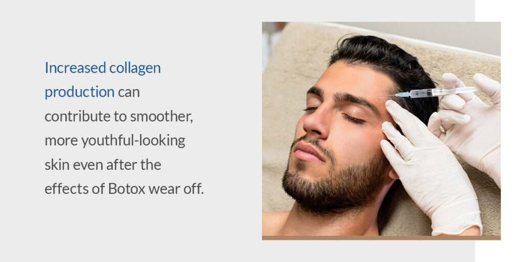 Botox 101: You Need to Know This Before Your First Injection